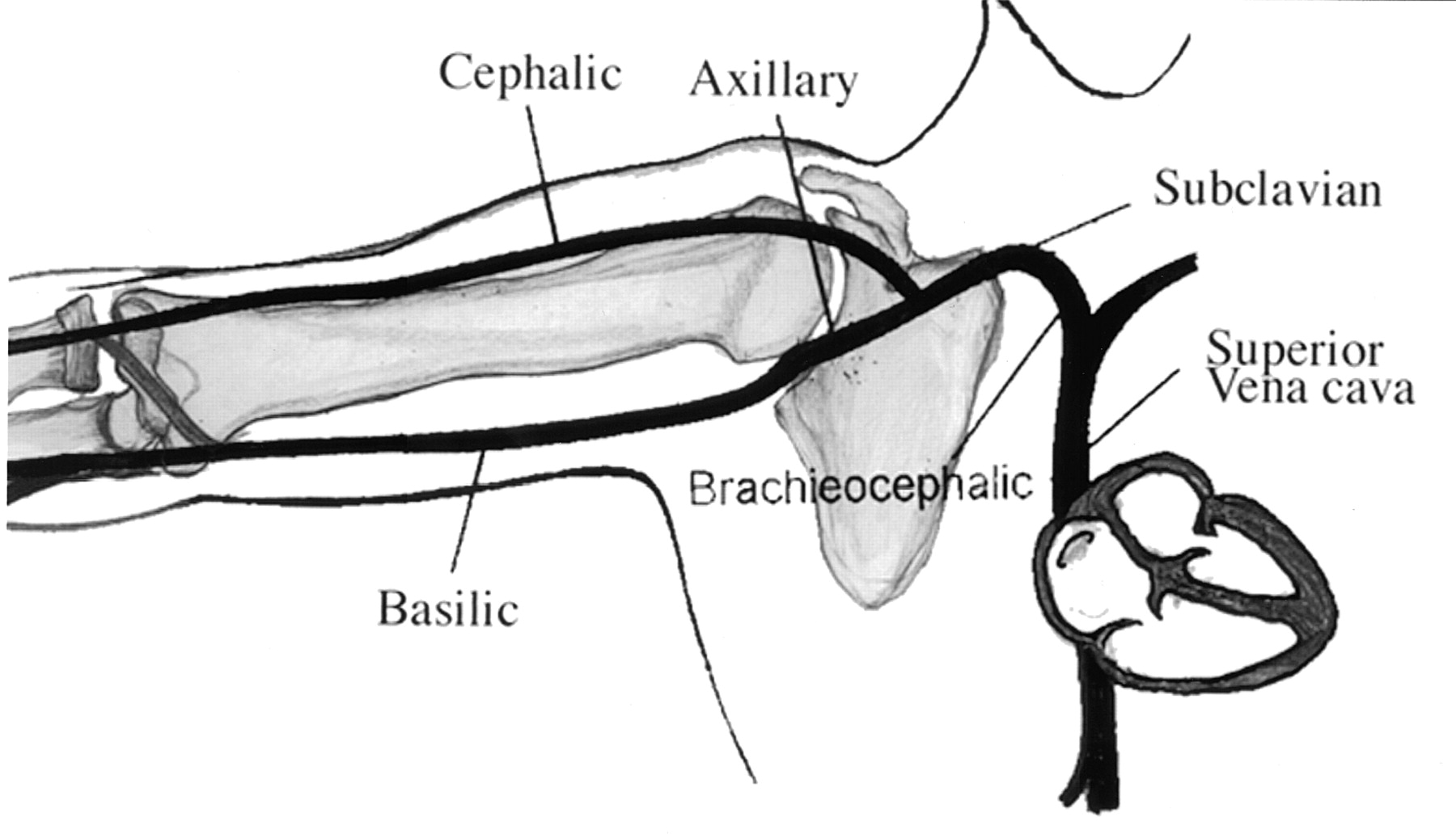 Upper Extremity Veins New Health Advisor